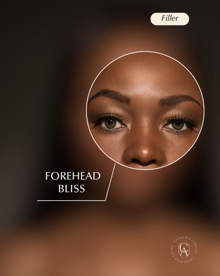 Cheeks & Forehead | Cosmedica Aruba
